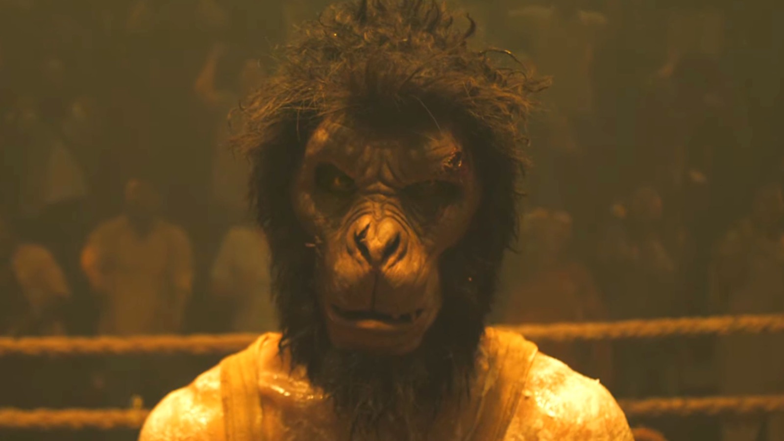 Dev Patel's Gross Monkey Man Injury Made One Body Part Look 'Like An ... Dev Patel's Gross Monkey Man Injury Made One Body Part Look 'Like An ...