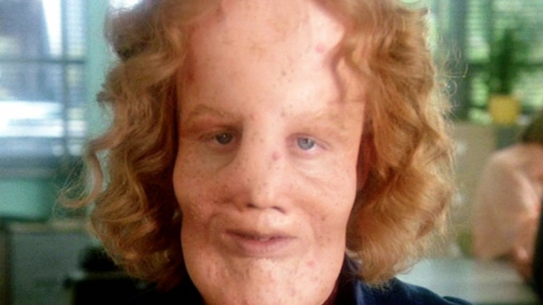 Actors Who Underwent Intense Facial Transformations For A Role